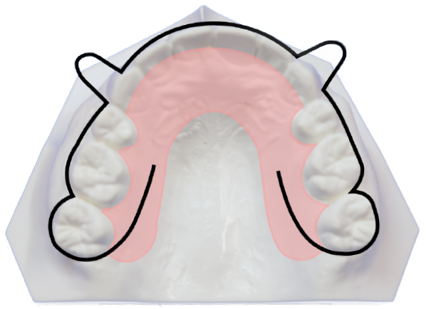 歯科矯正専門技工所 | 株式会社アンウォール